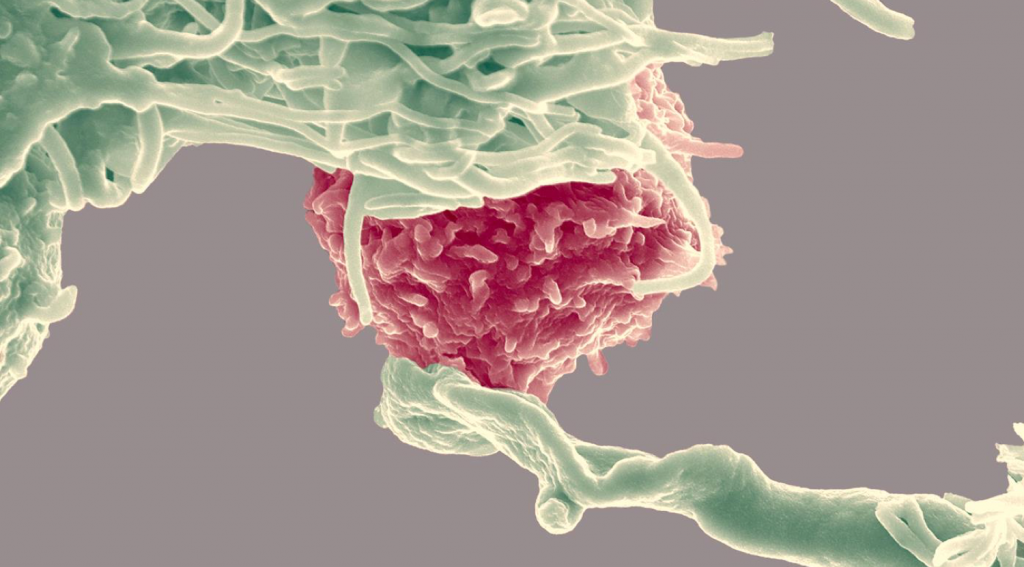 Therapy Pipeline – Syntrix Pharmaceuticals